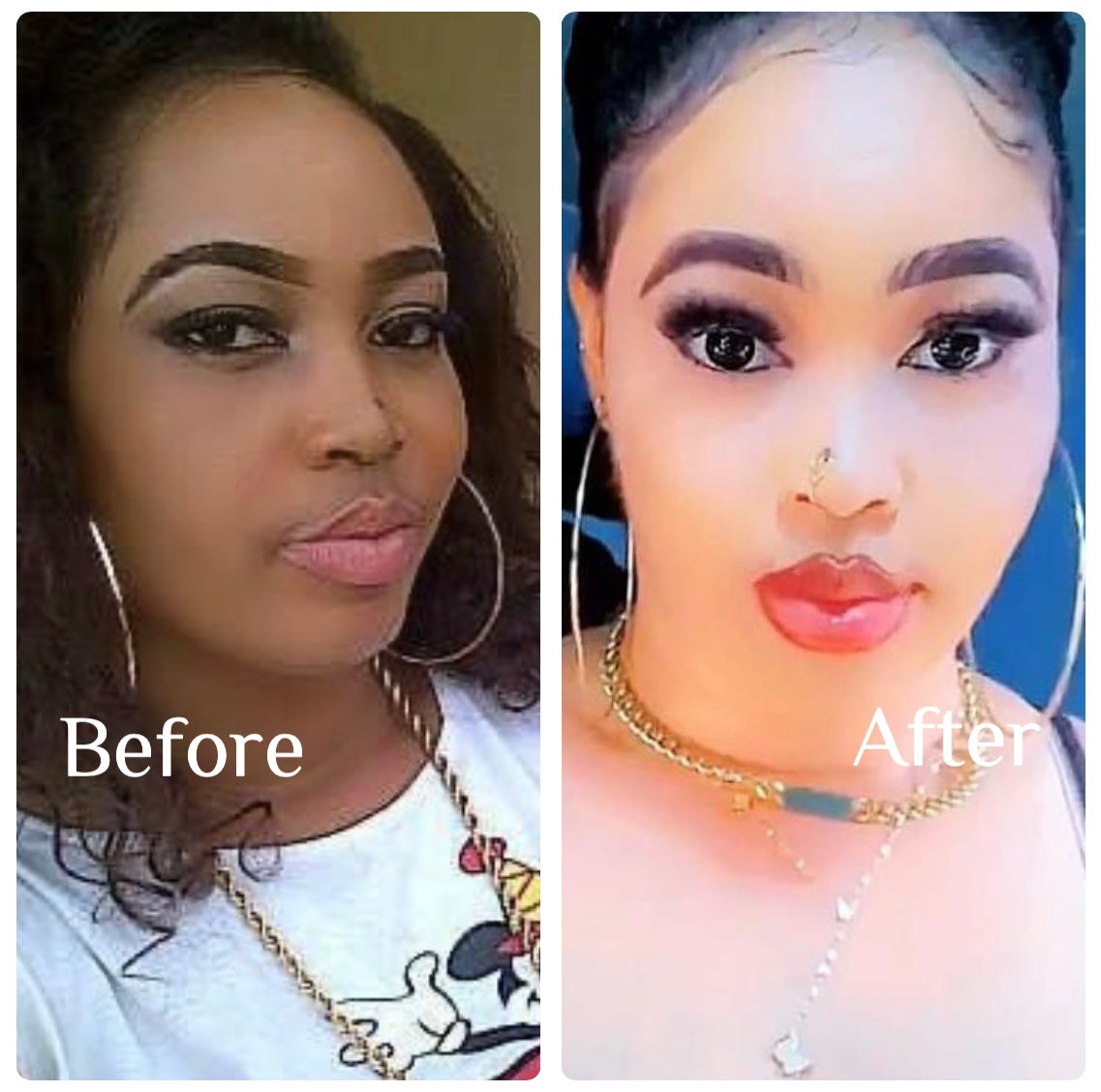 Egyptian Albino skin whitening cream - World of Entertainment23